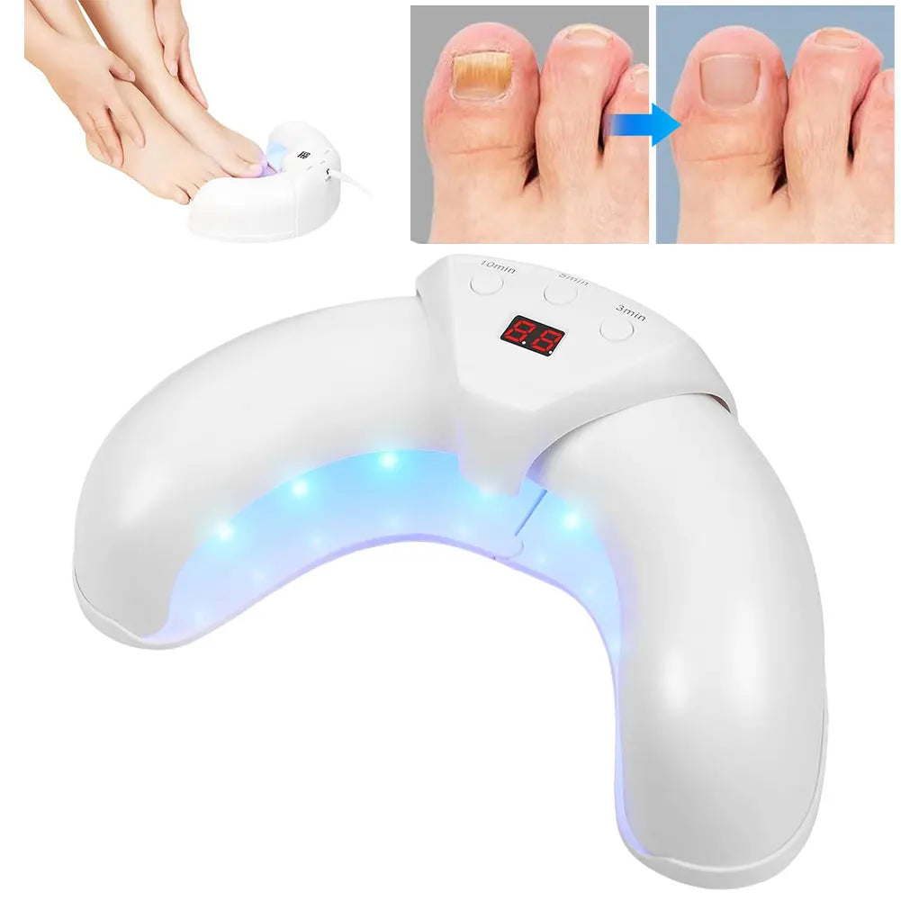 Foldable Nail Fungus Laser Treatment Device – Multi-Toenail & Fingerna ...